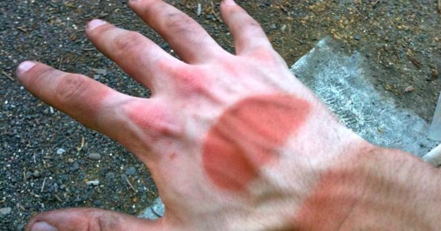 Sunburn on Hands? Best Sun Gloves for Hiking & Cycling - Mom Goes Camping