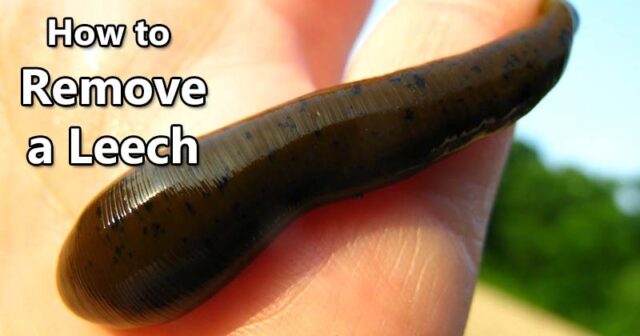 How to Safely Remove a Leech: What Actually Works