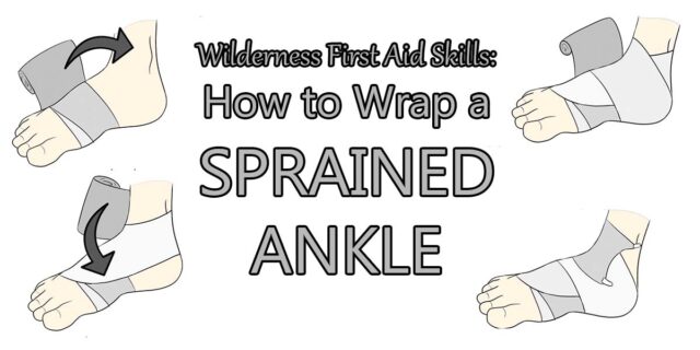 How to Wrap a Sprained Ankle: Bandage and Tape Methods (Infographic ...
